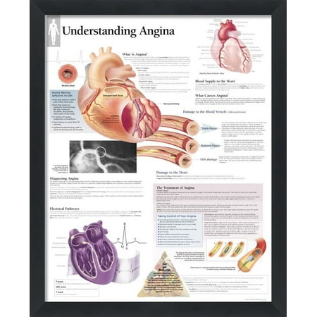 Wallsthatspeak Understanding Angina Framed Medical Educational ...